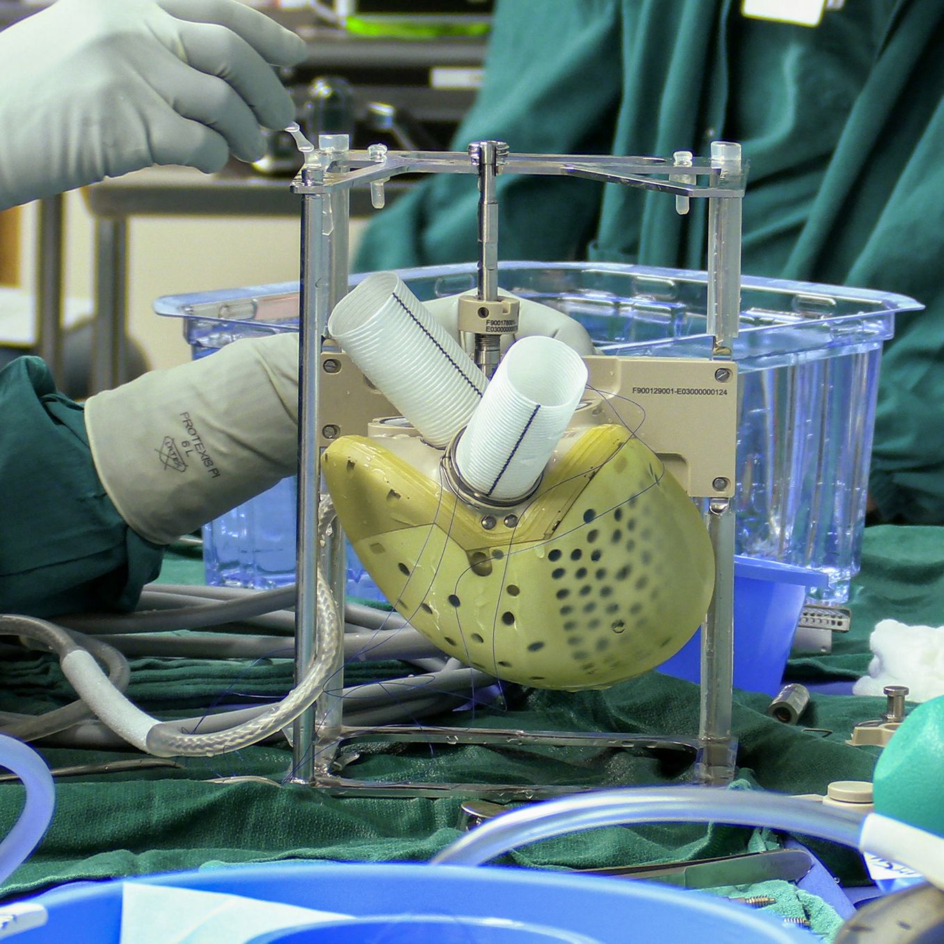 South Africa’s first person to have mechanical heart device implanted ...