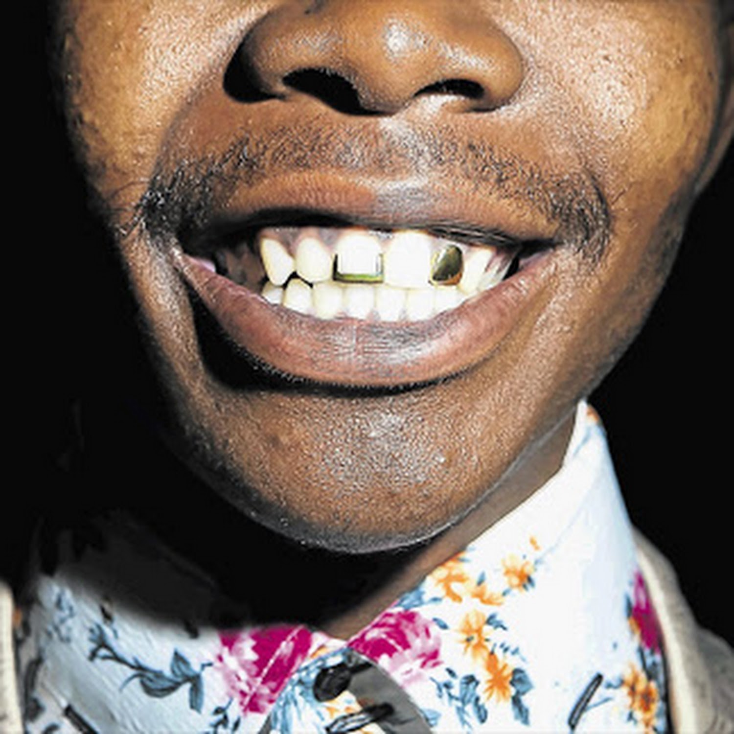 The real reason why people get a gold tooth | News365.co.za